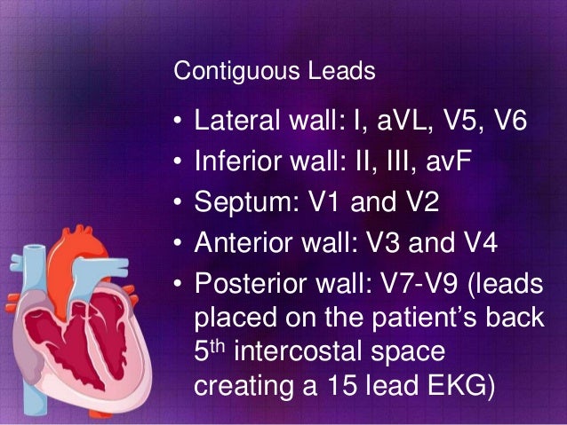What are contiguous leads - fetishver