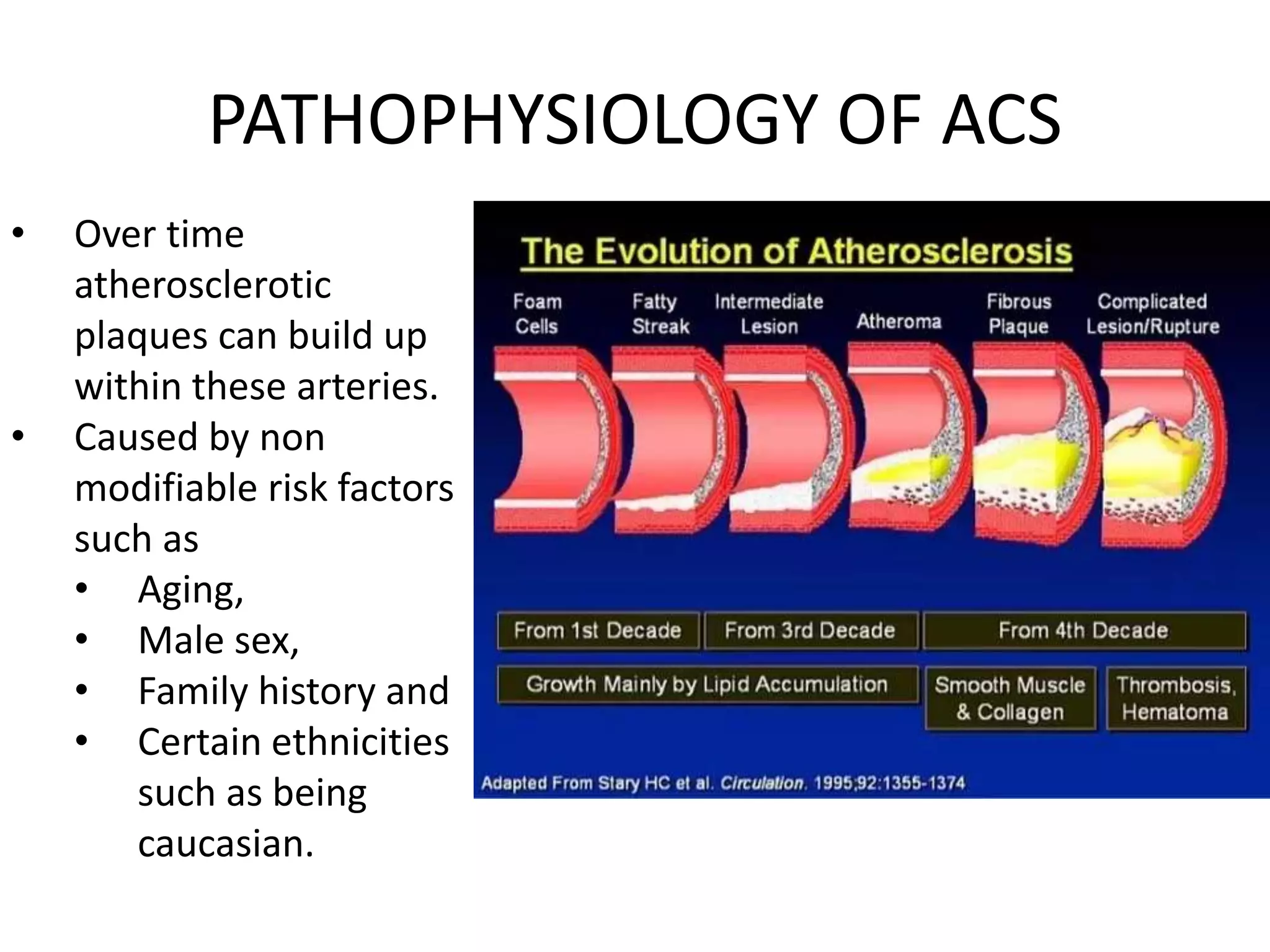 Ecg in acute coronary syndrome and acute care | PPT