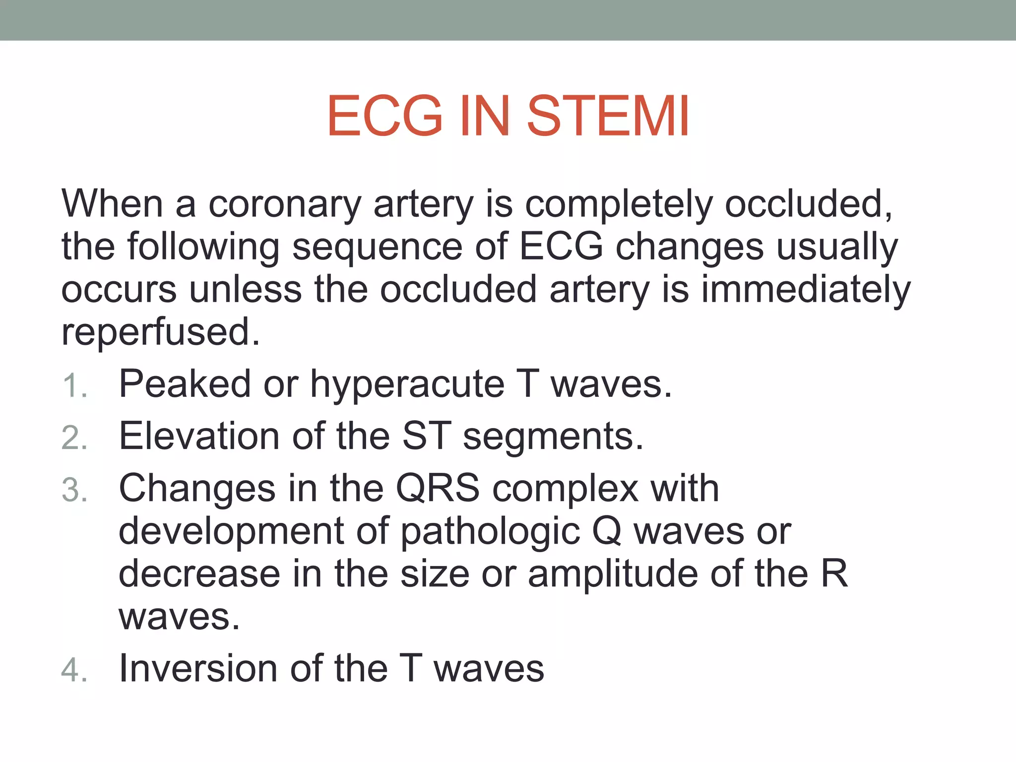 ECG in Acute Myocardial Infarction | PPTX