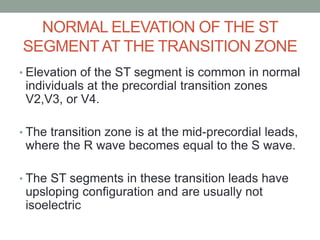 ECG in Acute Myocardial Infarction | PPTX