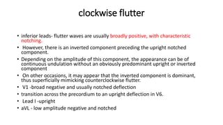Ecg in aflutter | PPTX