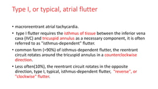 Ecg in aflutter | PPTX
