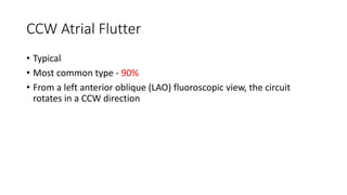 Ecg in aflutter | PPTX