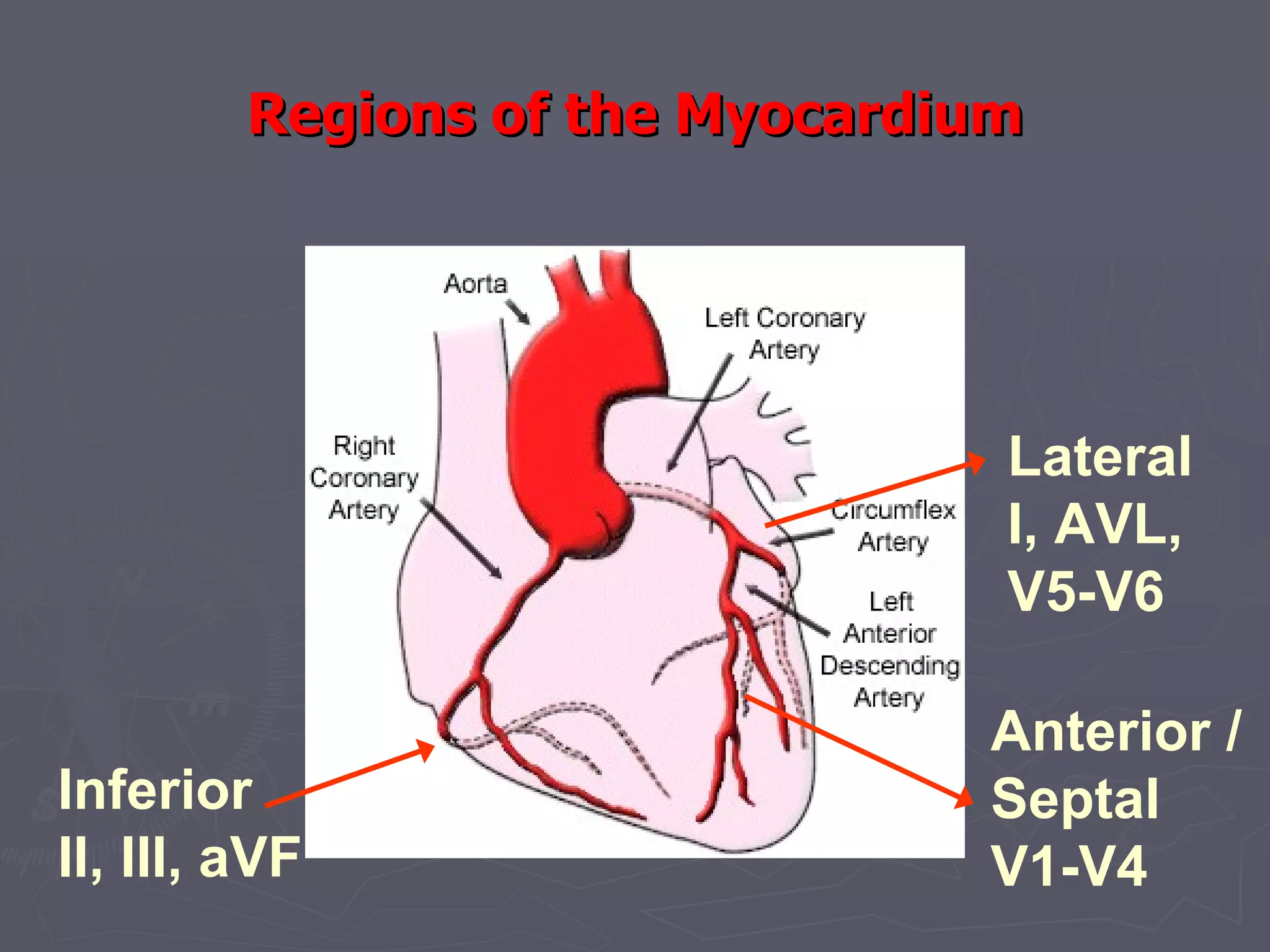 Ecg in AMI | PPT