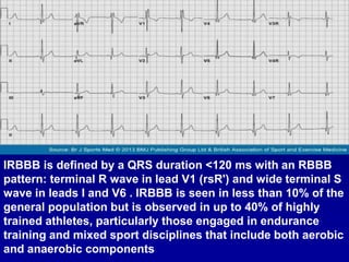 Ecg in athletes limits of normal-samir rafla . cardio egypt 2015 | PPT