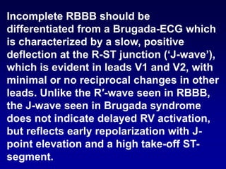 Ecg in athletes limits of normal-samir rafla . cardio egypt 2015 | PPT
