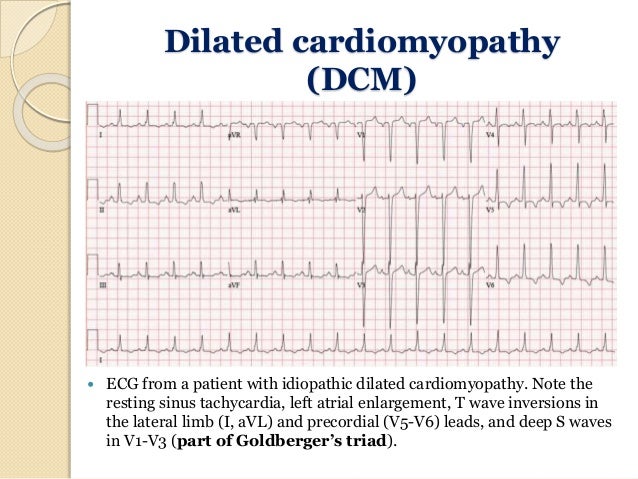 Ecg in athletes and young age