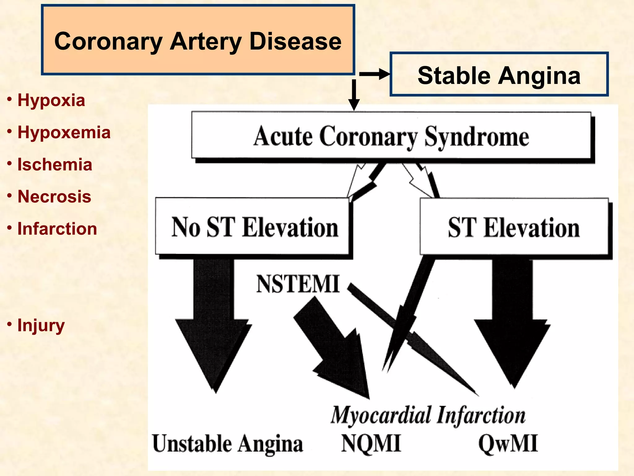 ECG in Coronary Artery Disease | PPT