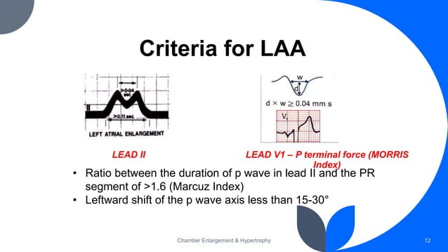 ECG in Chamber Enlargement.pptx