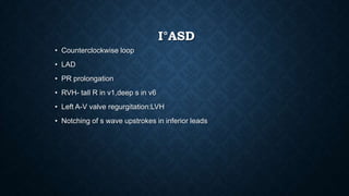 Ecg in congenital heart disease | PPTX