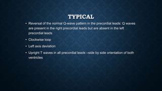Ecg in congenital heart disease | PPTX