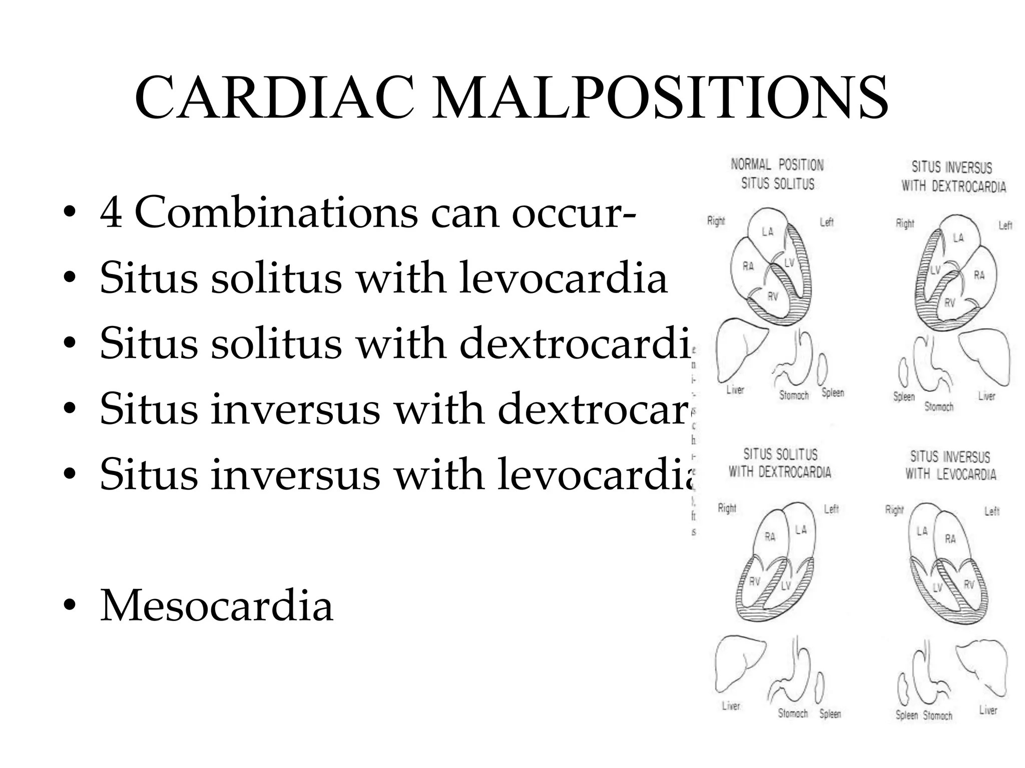 electrocardiogram (Ecg) in CONGENITAL HEART DISEASES | PPTX