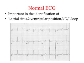electrocardiogram (Ecg) in CONGENITAL HEART DISEASES | PPTX