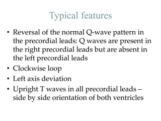 electrocardiogram (Ecg) in CONGENITAL HEART DISEASES | PPTX