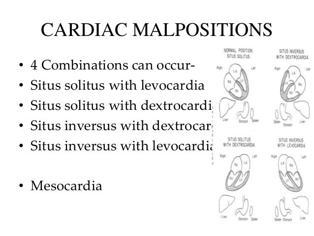 electrocardiogram (Ecg) in CONGENITAL HEART DISEASES