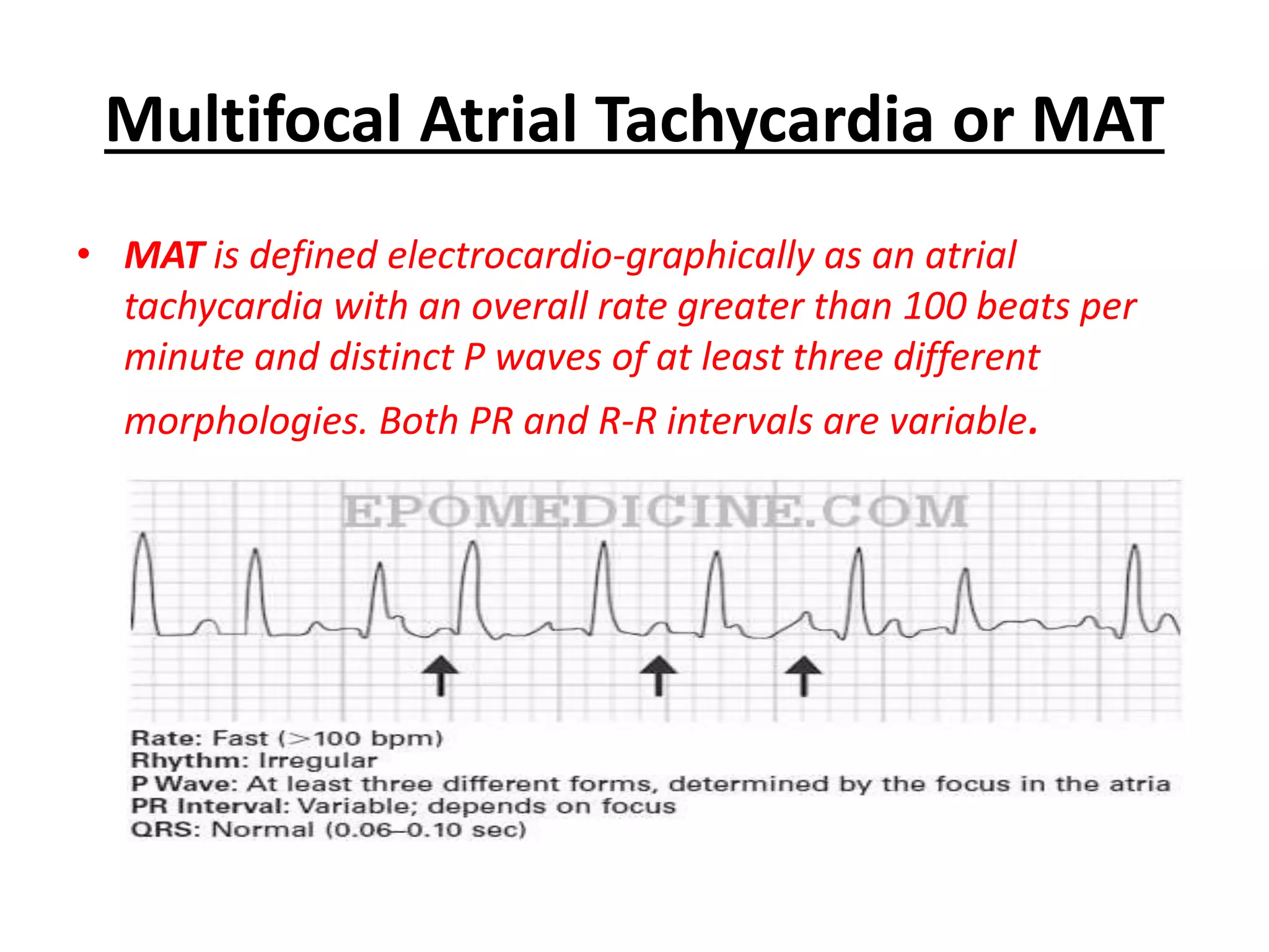 ECG/EKG changes in COPD | PPTX