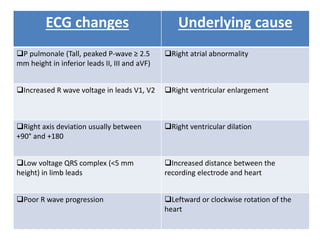 ECG/EKG changes in COPD | PPTX