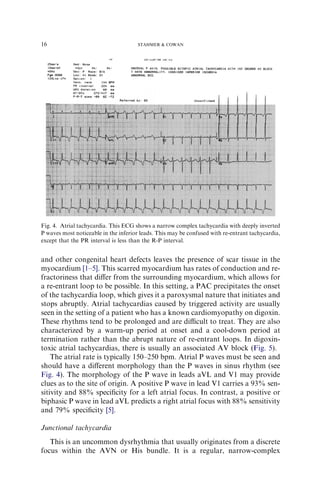 MWEBAZA VICTOR - ECG in Emergency Medicine.pdf