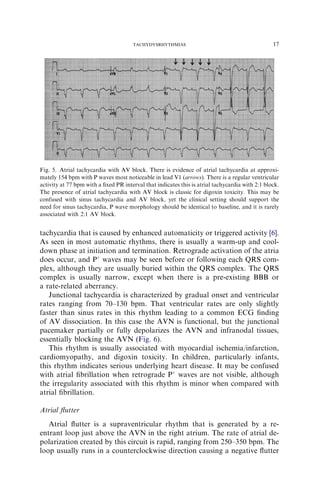 MWEBAZA VICTOR - ECG in Emergency Medicine.pdf