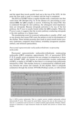 MWEBAZA VICTOR - ECG in Emergency Medicine.pdf
