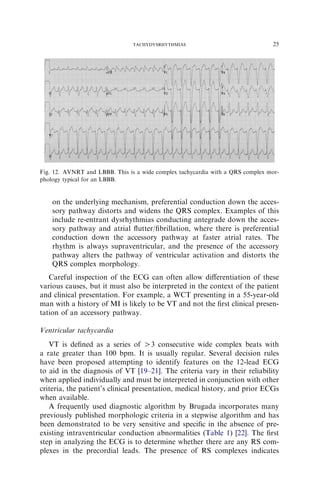 MWEBAZA VICTOR - ECG in Emergency Medicine.pdf