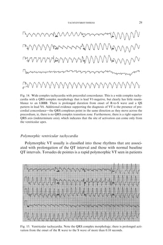 MWEBAZA VICTOR - ECG in Emergency Medicine.pdf