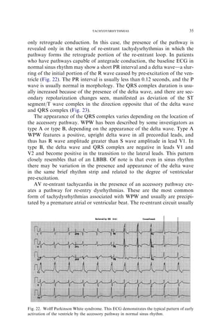 MWEBAZA VICTOR - ECG in Emergency Medicine.pdf