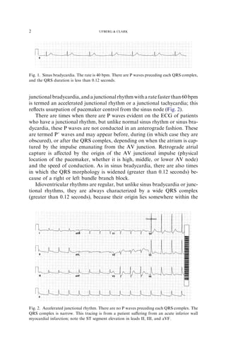 MWEBAZA VICTOR - ECG in Emergency Medicine.pdf