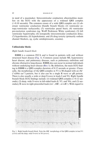 MWEBAZA VICTOR - ECG in Emergency Medicine.pdf