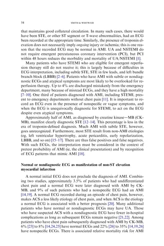 MWEBAZA VICTOR - ECG in Emergency Medicine.pdf