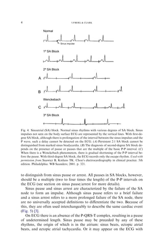 MWEBAZA VICTOR - ECG in Emergency Medicine.pdf