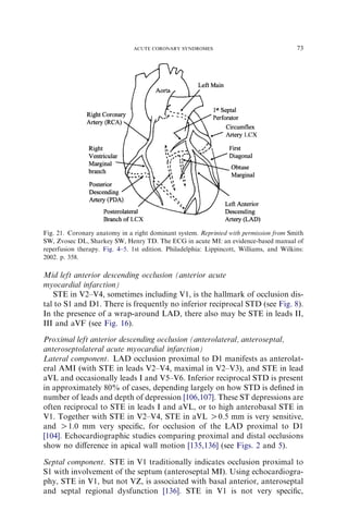MWEBAZA VICTOR - ECG in Emergency Medicine.pdf