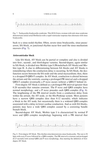 MWEBAZA VICTOR - ECG in Emergency Medicine.pdf