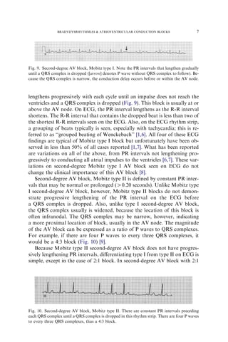 MWEBAZA VICTOR - ECG in Emergency Medicine.pdf