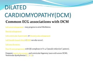 Ecg in emergency room | PPTX