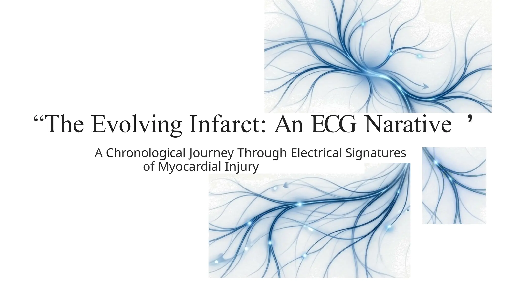ECG of Myocardial Infarction- Evolution.pptx
