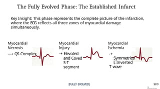 ECG of Myocardial Infarction- Evolution.pptx