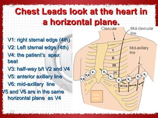 ECG In Ischemic Heart Disease - Dr Vivek Baliga Review | PPT