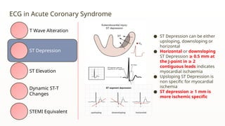 ECG in Ischemia Heart Disease RSMWM.pptx