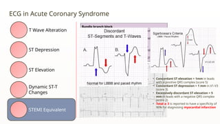 ECG in Ischemia Heart Disease RSMWM.pptx