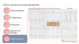 ECG in Ischemia Heart Disease RSMWM.pptx