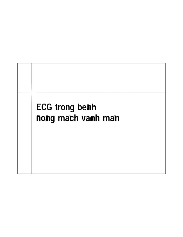 ECG TRONG NONSTEMI | PDF