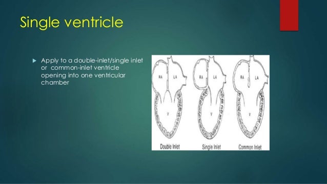 Ecg in single ventricle