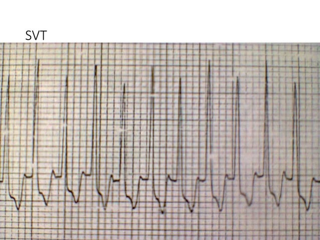 ECG in Companion Animal Practice | PPT