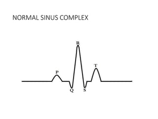 ECG in Companion Animal Practice | PPT