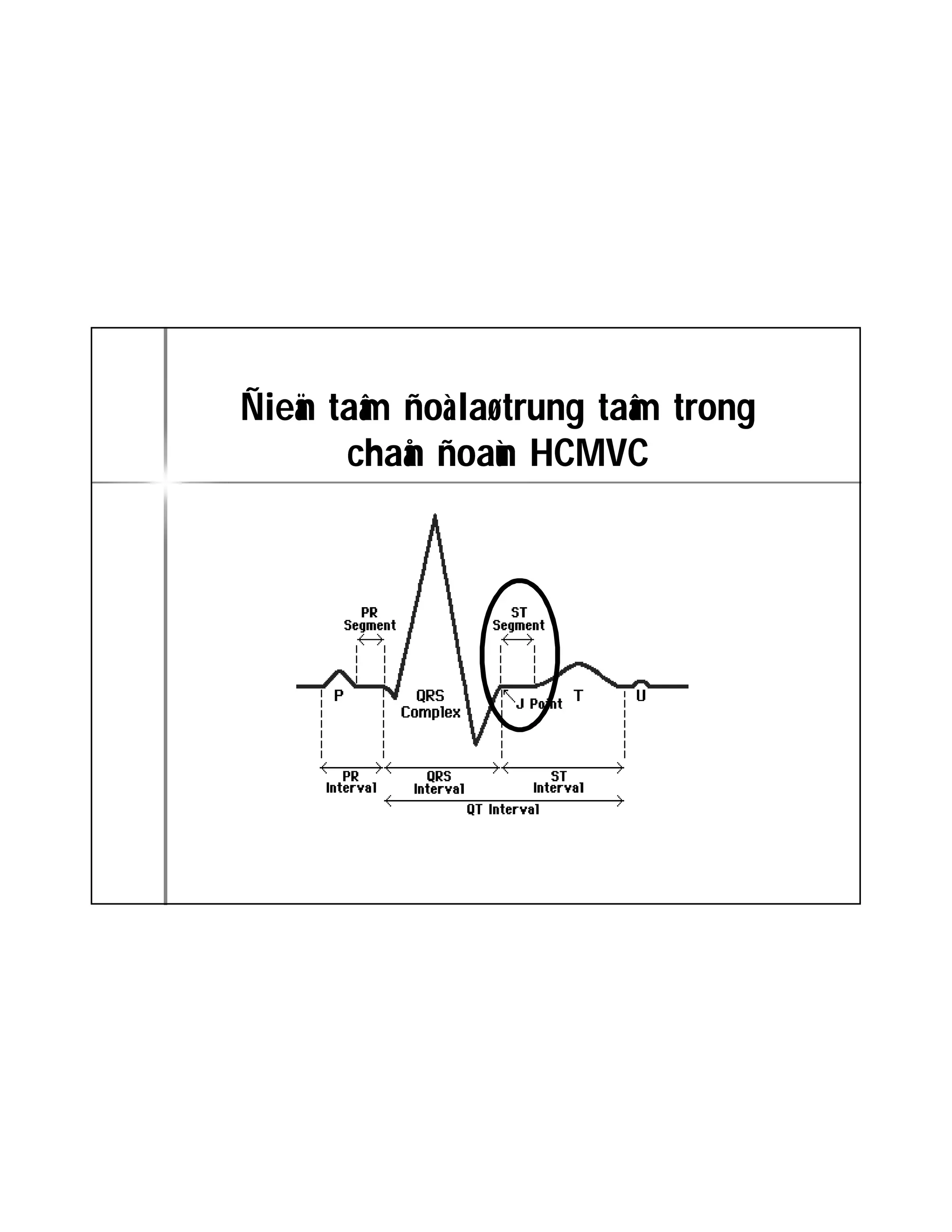 ECG TRONG STEMI | PDF