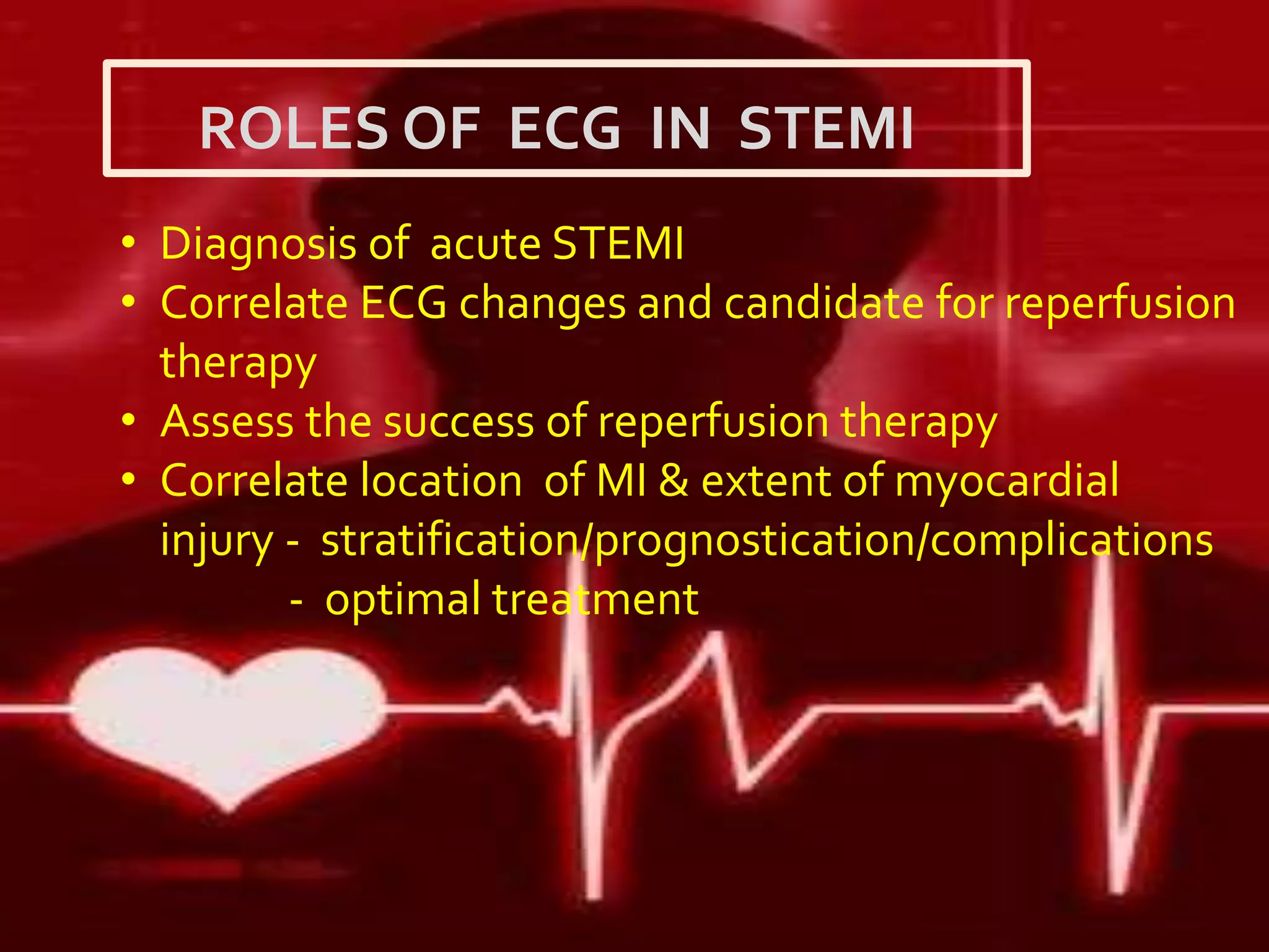 ECG IN STEMI.ppt