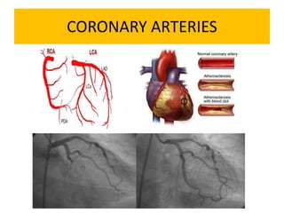 ECG IN STEMI.ppt