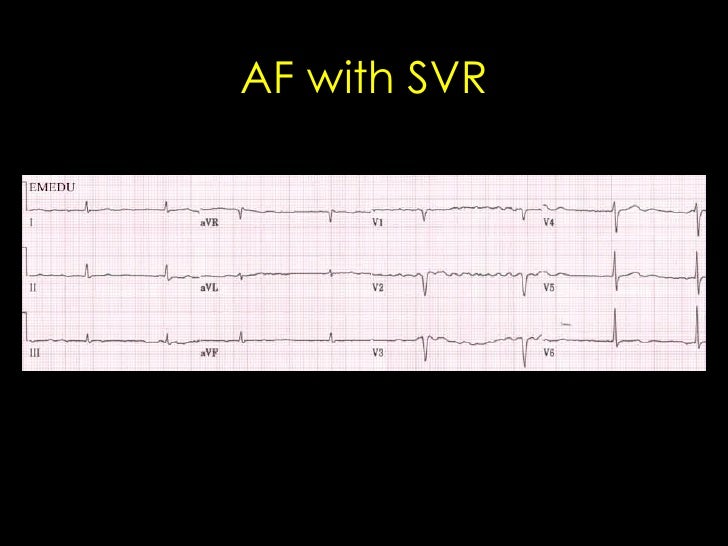 ELECTROCARDIOGRAM