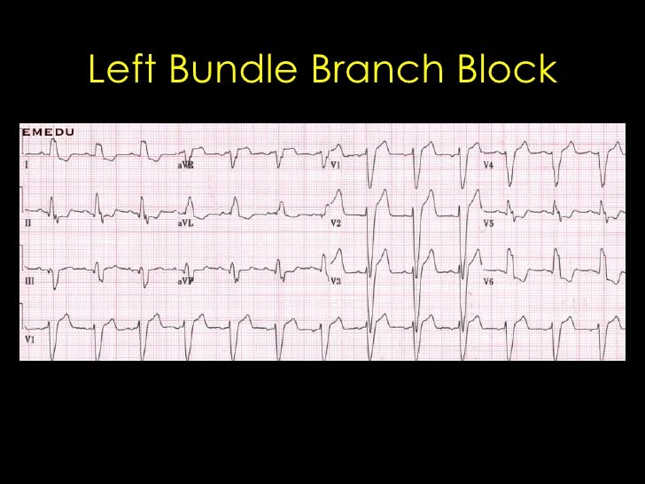 ELECTROCARDIOGRAM
